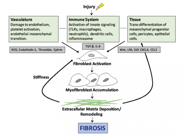 Targeted Therapy for Scleroderma Fibrosis - Page 2 of 6 - The ...