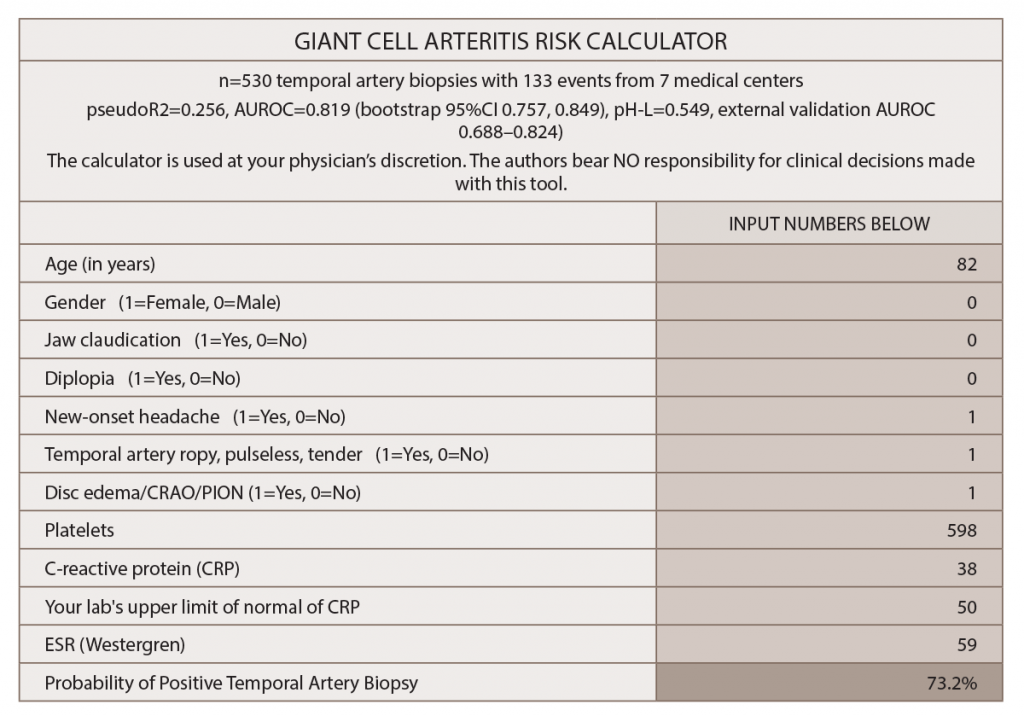Experts Discuss Proposed Giant Cell Arteritis Risk Tool - Page 2 of 6 - The Rheumatologist