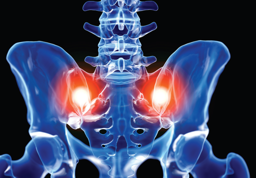 Imaging of Axial Psoriatic Arthritis - The Rheumatologist