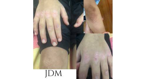 ACR Image Competition 2021 Results, Part 6 - The Rheumatologist