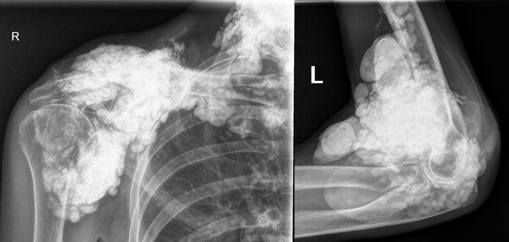 ACR Image Competition 2022 Results, Part 2 - The Rheumatologist