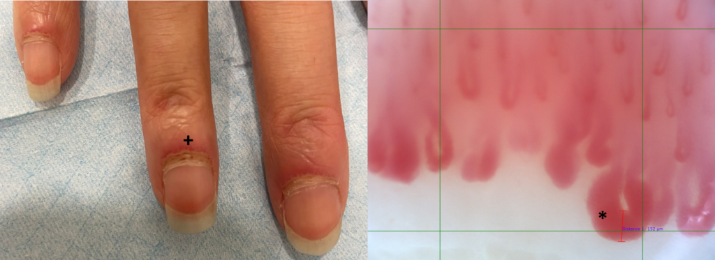 ACR Image Competition 2022, Part 4 - The Rheumatologist