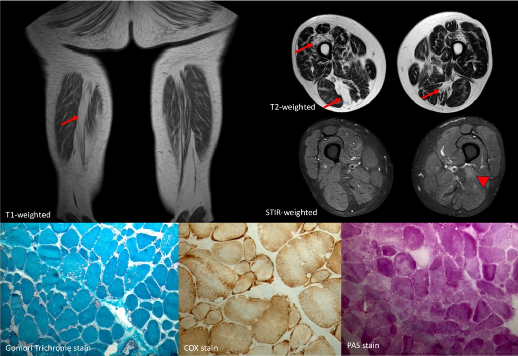 ACR Image Competition 2023 Results, Part 2 - The Rheumatologist