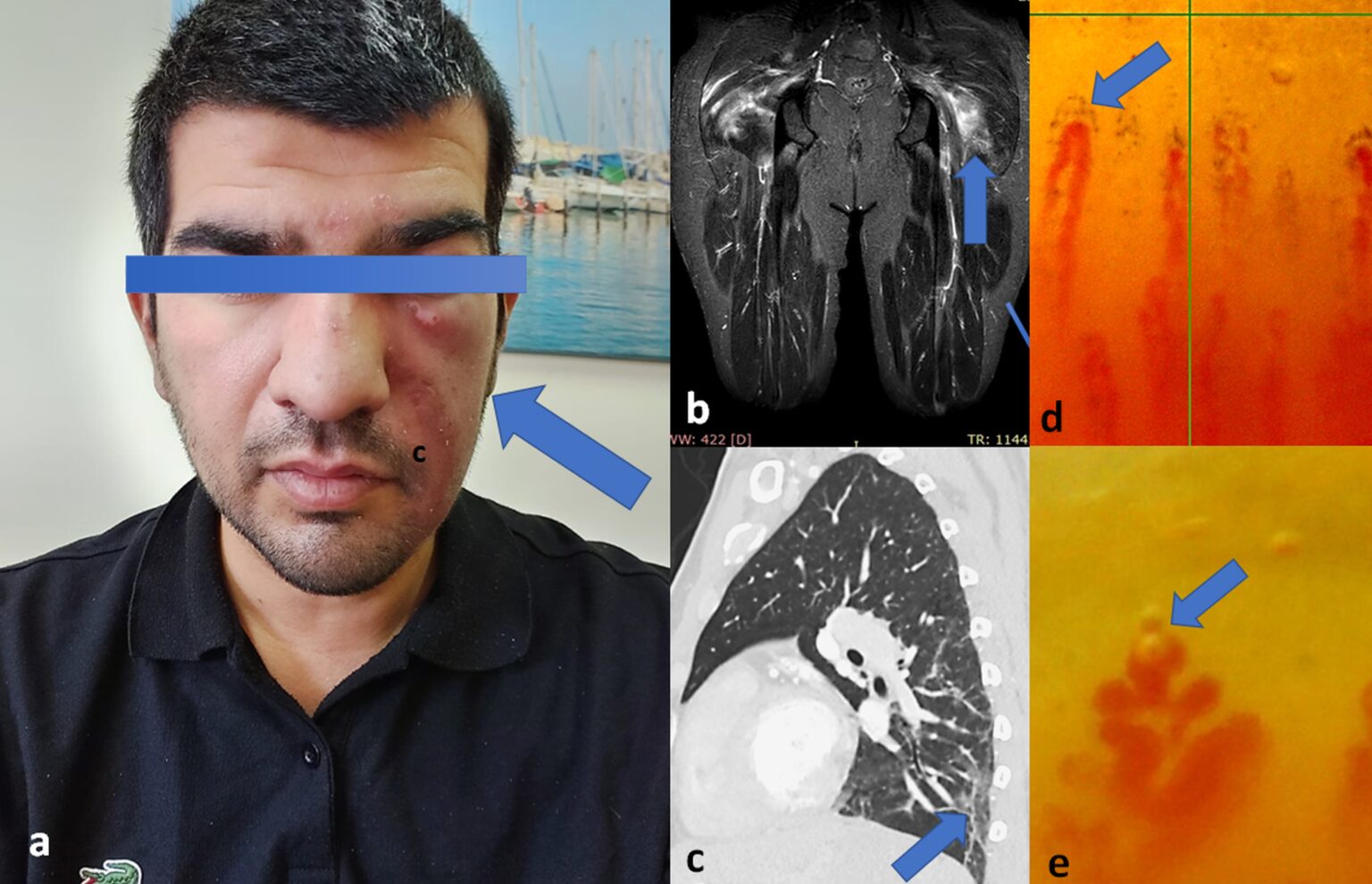 ACR Image Competition 2023 Results, Part 4 - The Rheumatologist