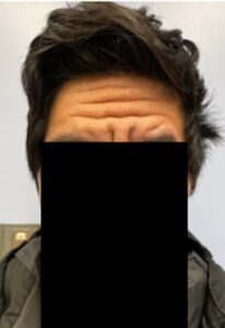 Case Report: Complicated Presentation Eventually Explained by Rare ...