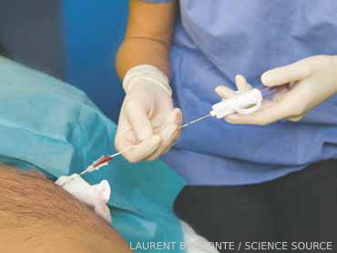 Kidney Biopsy in Lupus Nephritis - The Rheumatologist