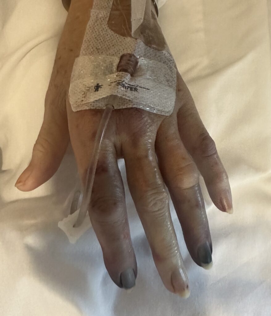 Case Report: An Uncommon Presenting Complaint of GPA - The Rheumatologist