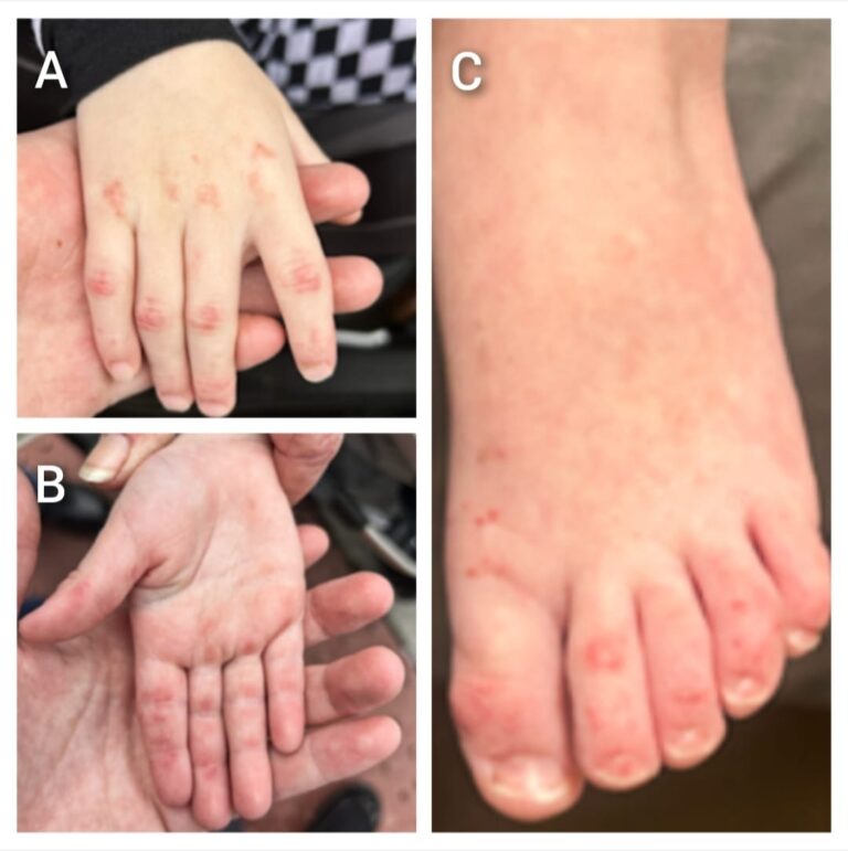 ACR Image Competition 2024 Results, Part 5 - The Rheumatologist